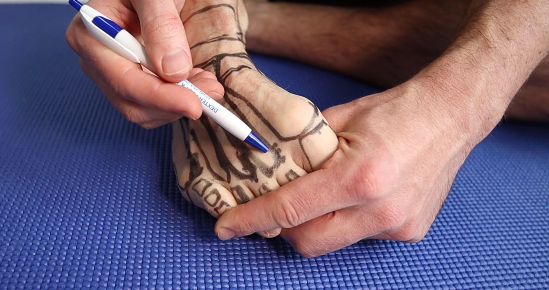 BEST Metatarsalgia Exercises, Massage & Stretches [HOME Treatment]